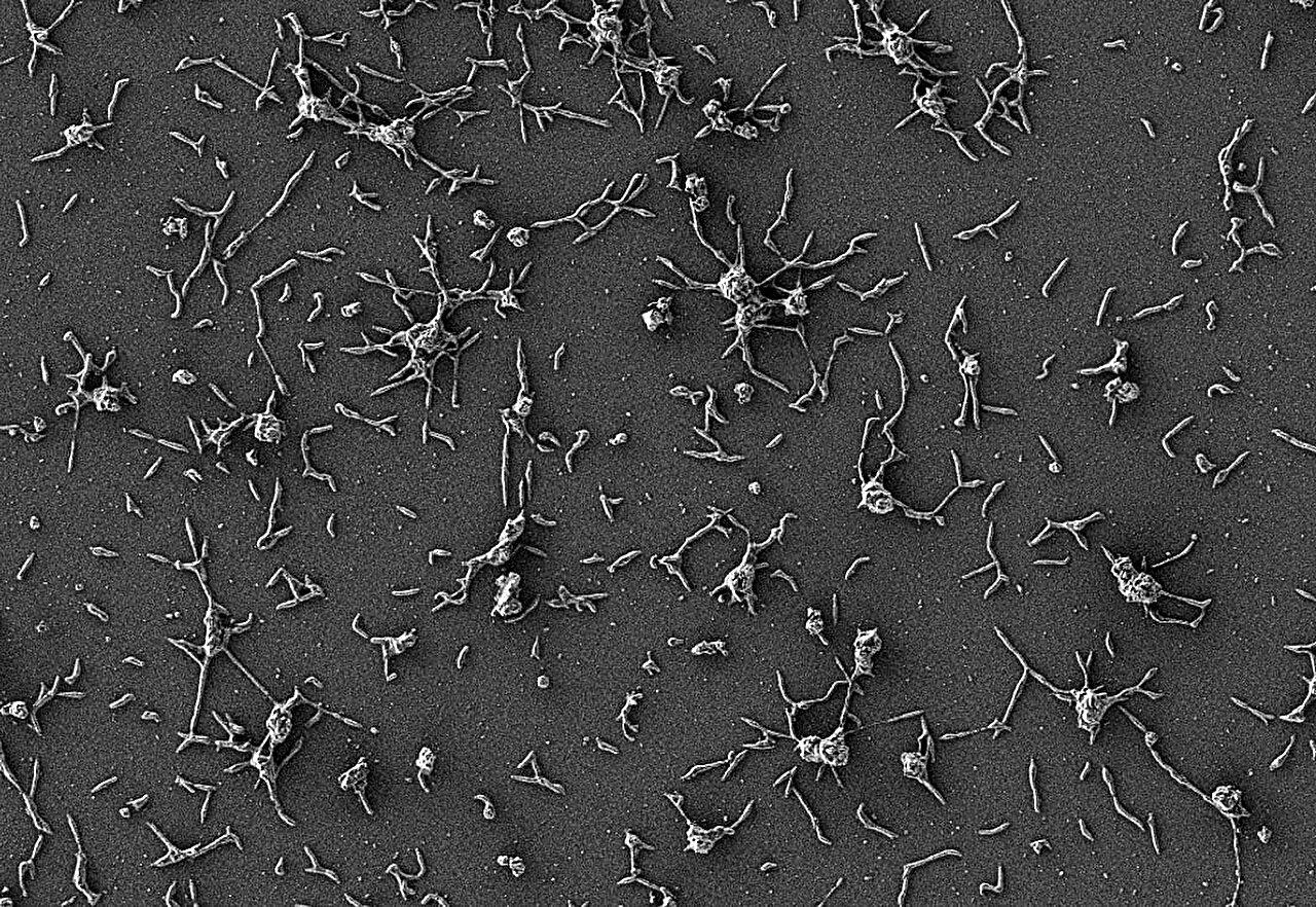 'Essentiality' scan reveals what Mycoplasma pneumoniae truly needs to ...