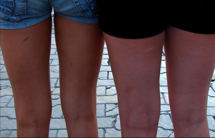20 People Who Stand Out From the Crowd for a Beautiful Reason