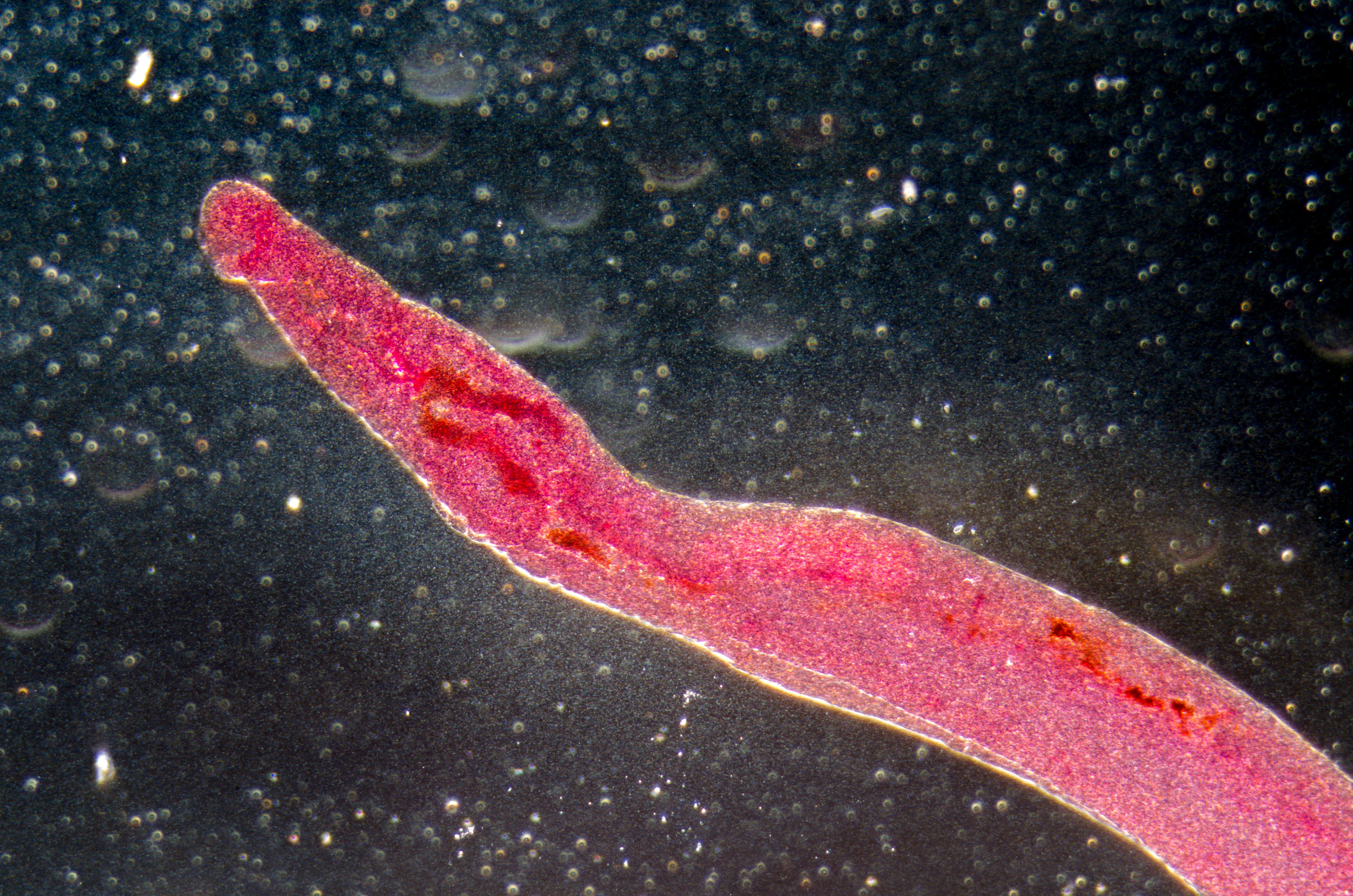 Opioids: Parasitic worm discovery could lead to safer painkillers
