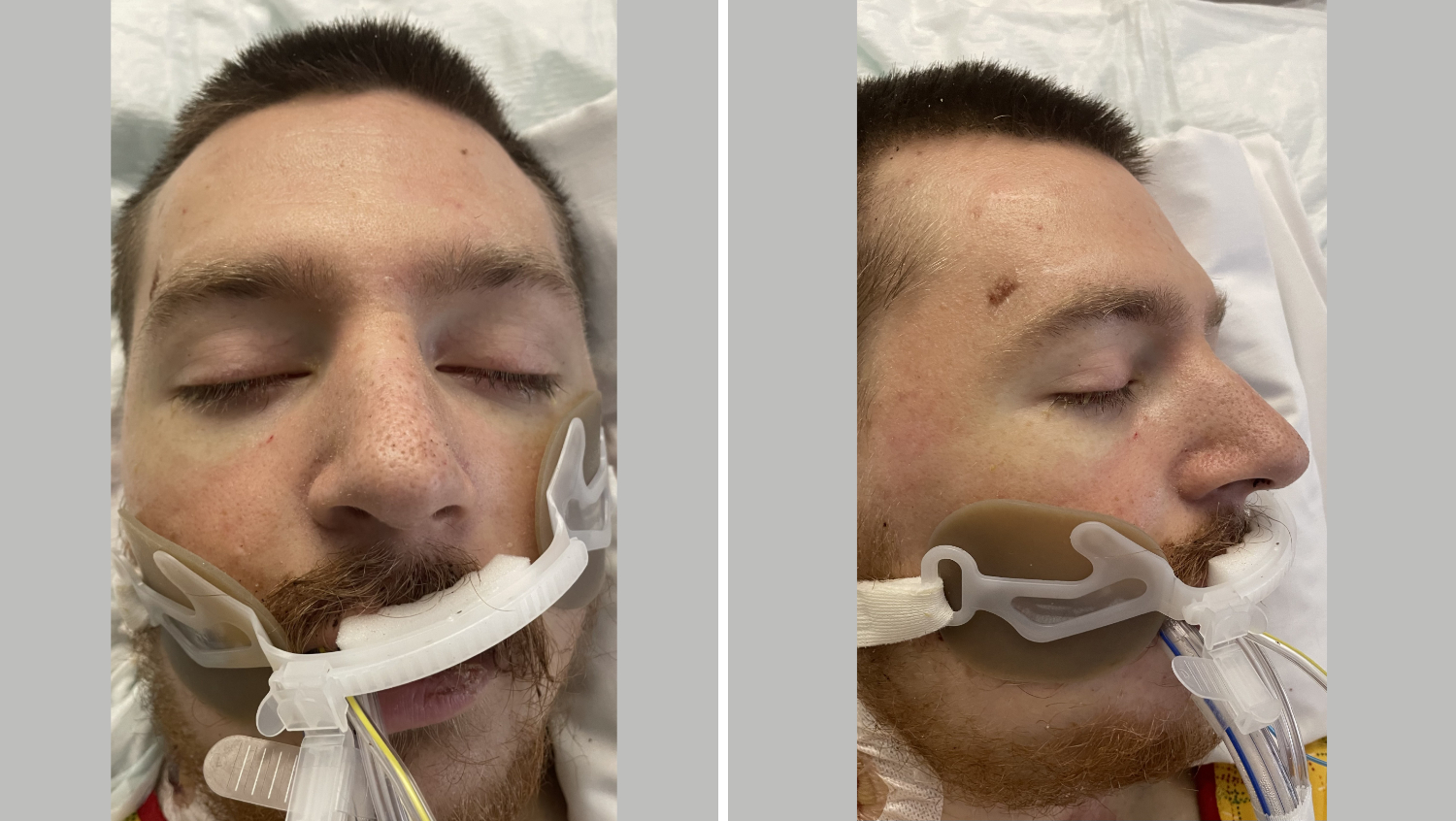 Temple University Hospital seeking public's help identifying patient