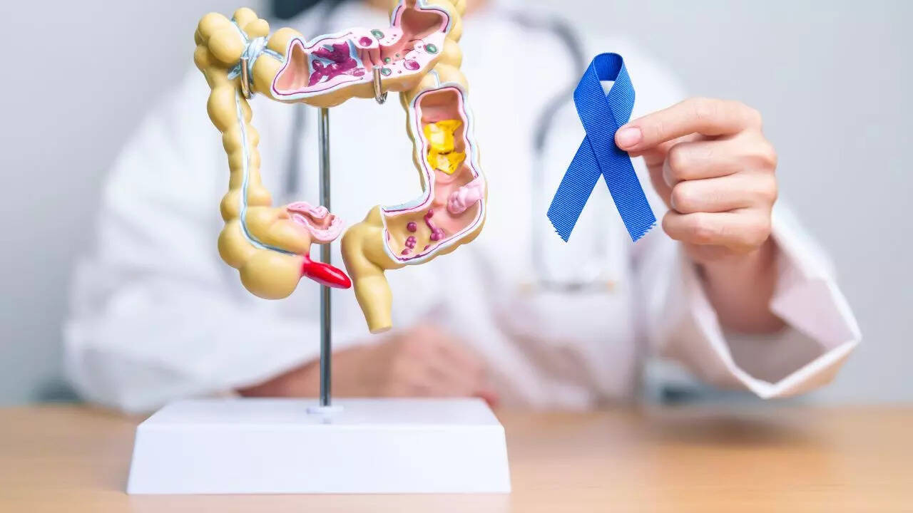 Never eat these foods as a colon cancer survivor: Protect your gut health