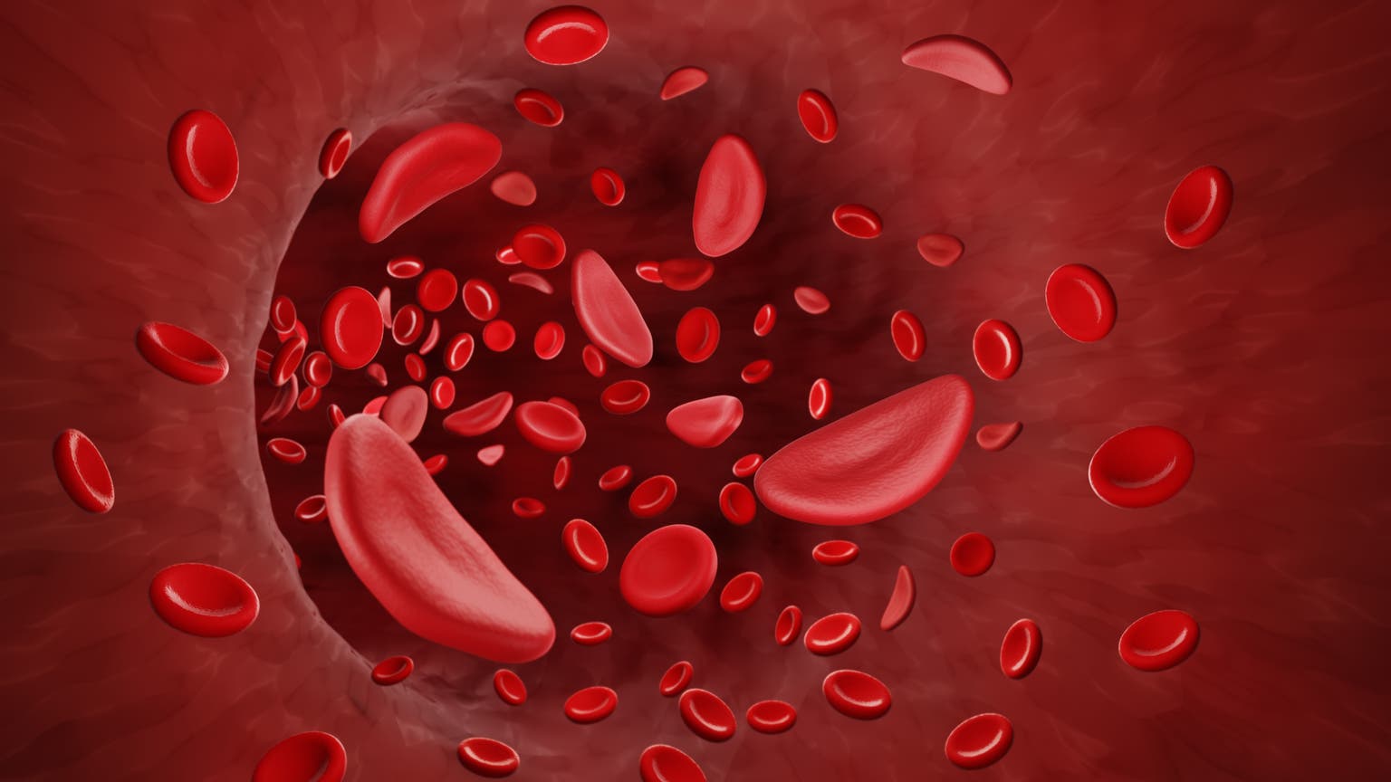 Beam gains FDA Regenerative Medicine Advanced Therapy status for sickle cell treatment