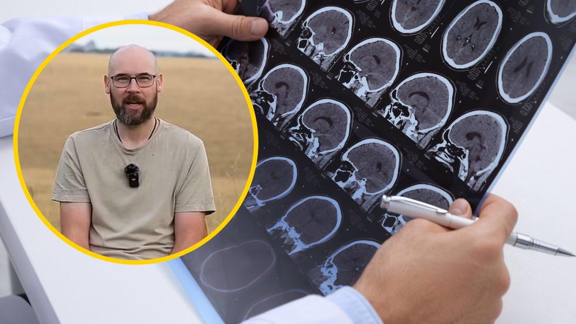 Miał 41 lat, gdy usłyszał diagnozę. "Zapomniałem, że oglądałem już ten ...