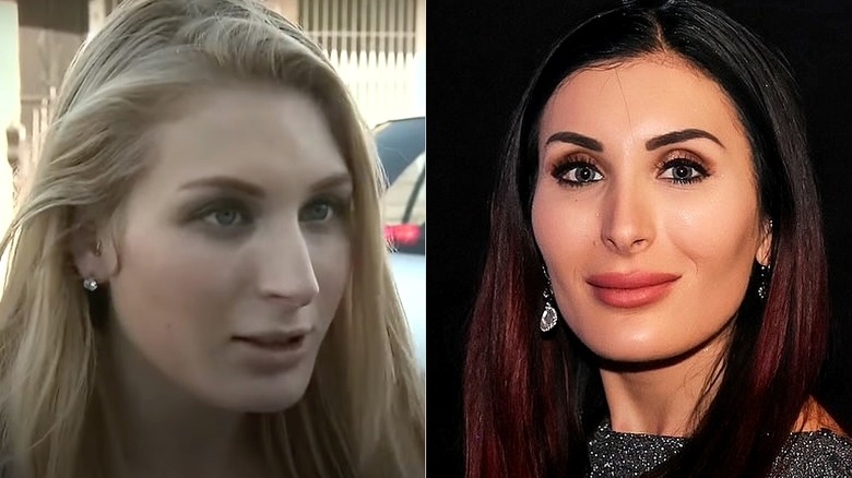 The Wildest Plastic Surgery Transformations In MAGA History