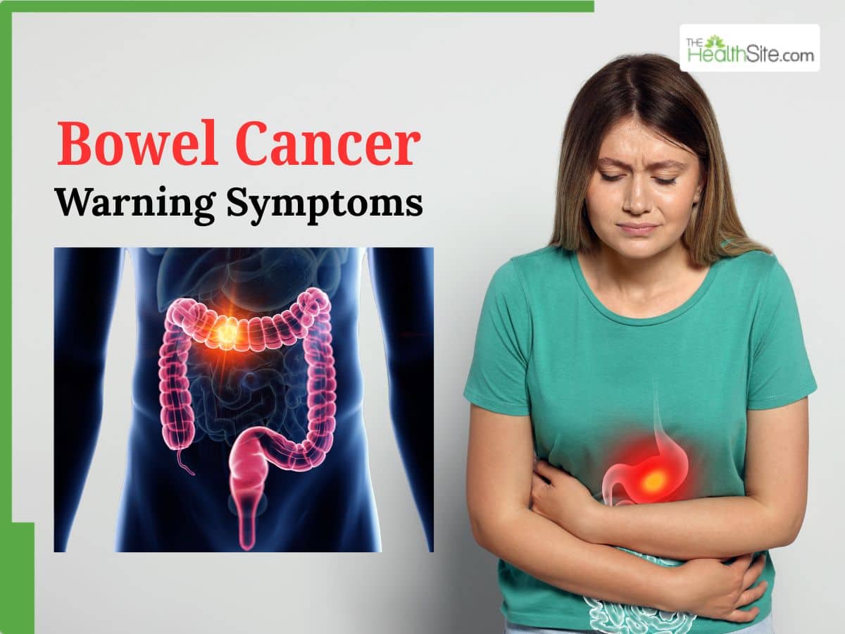 Bowel Cancer Symptoms: 5 Early Warning Signs You Shouldn’t Ignore