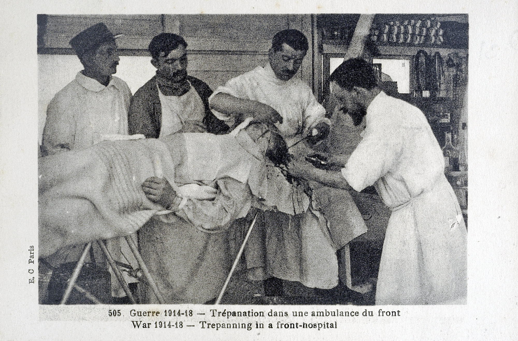 16 Weird Old Cures Doctors Once Believed In