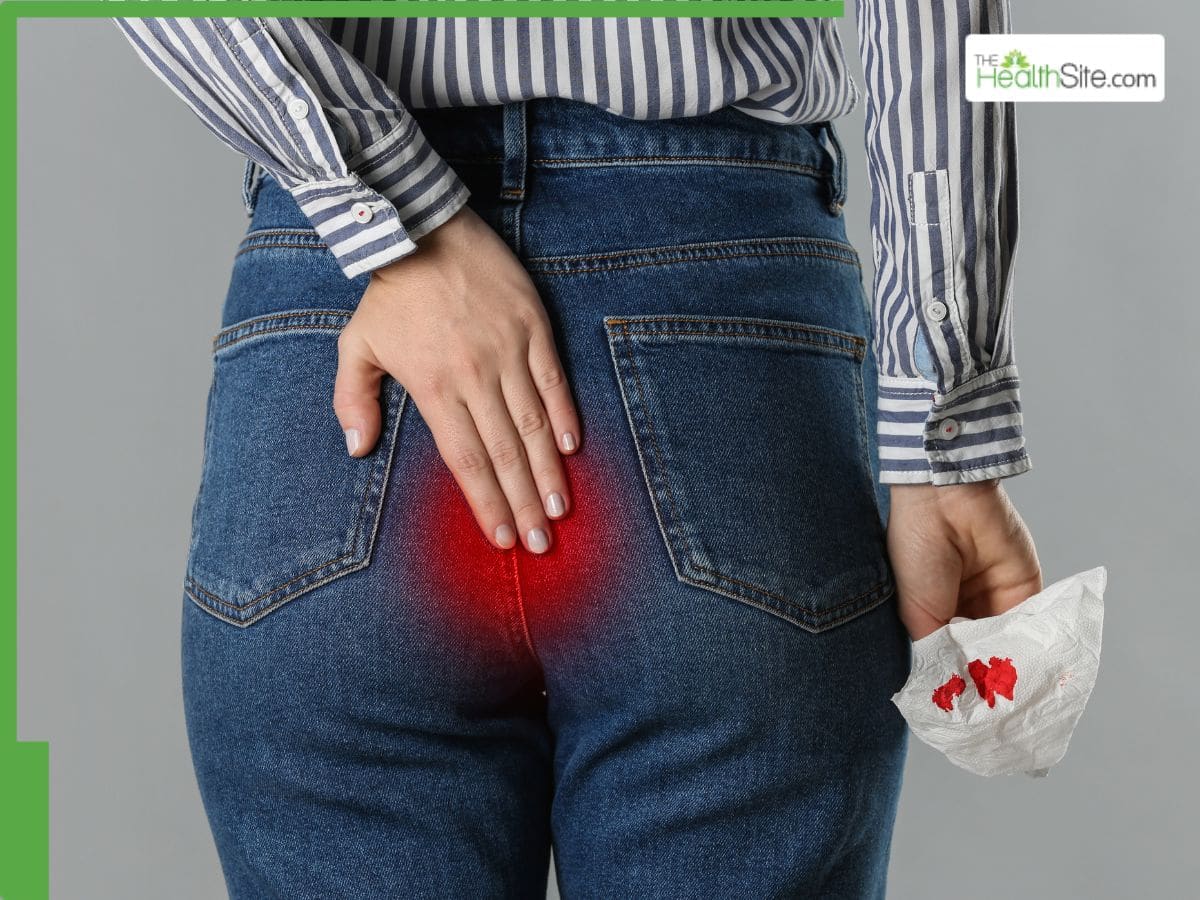 Bowel Cancer Symptoms: 5 Early Warning Signs You Shouldn’t Ignore
