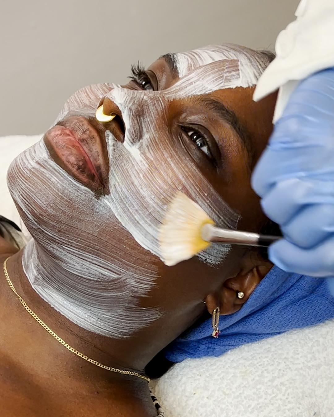 The Perfect Facial for Hyperpigmentation