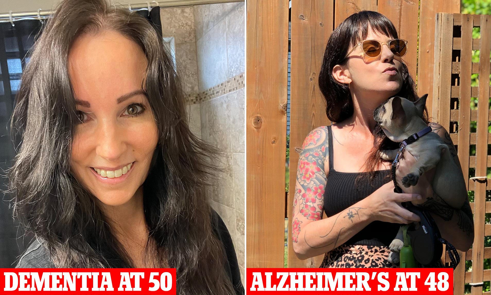 Scientists discover how to 'truly reverse' memory loss by switching off proteins in the brain