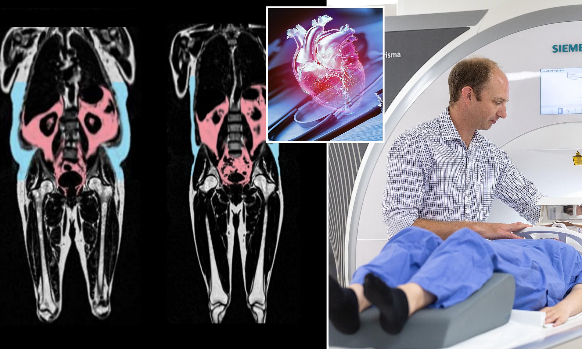 Hidden body fat could be secretly ageing you, even if you're skinny ...