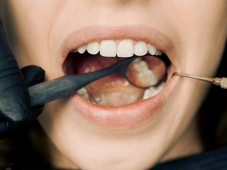 Oral cancer: What research says about the biggest causes and how to ...
