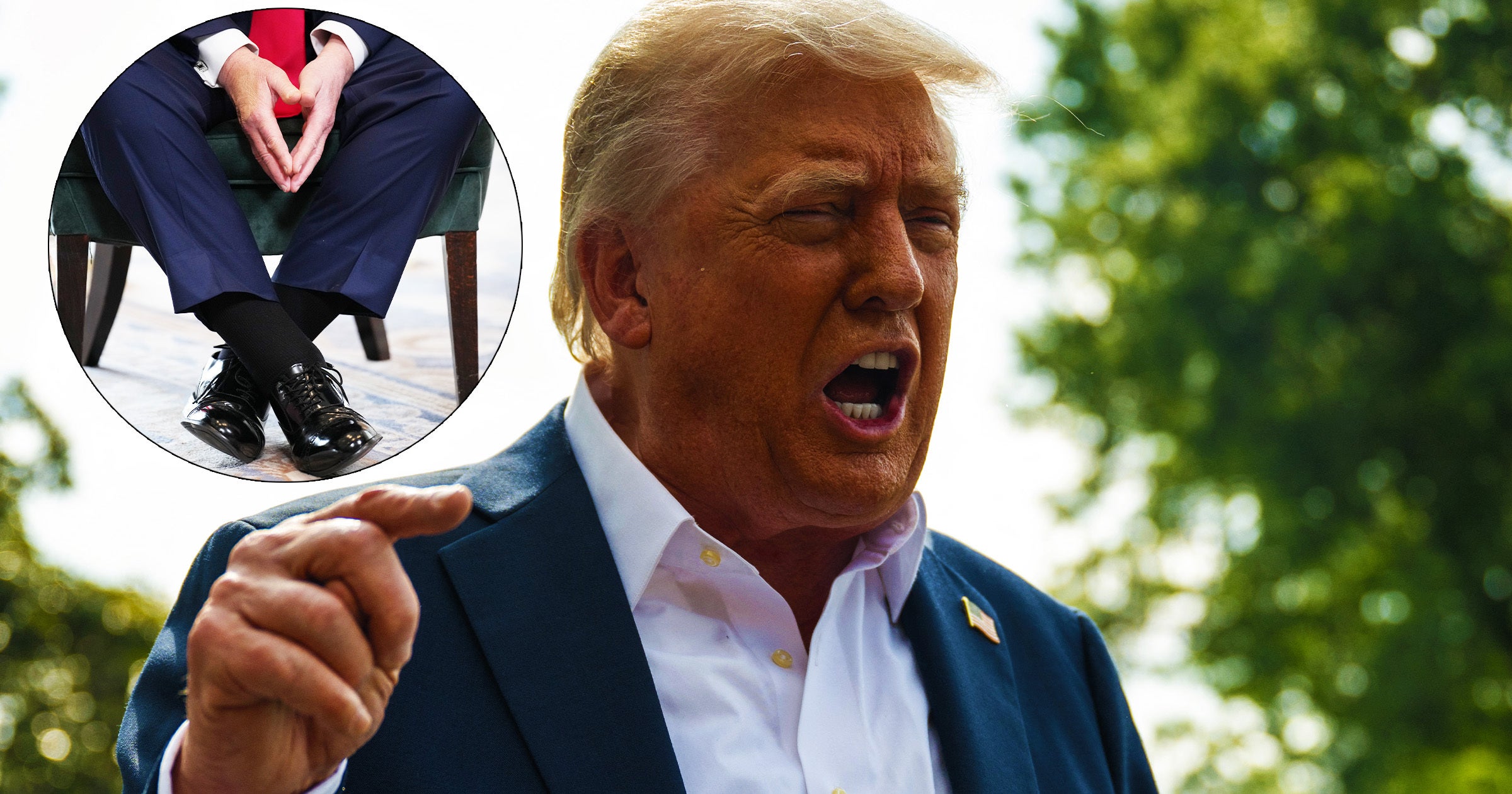 Trump Rages as His Swollen Legs Are Scrutinized