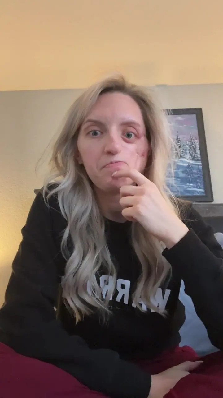 Mujer descubre cáncer tras meses de dolor ignorado por médicos y muere ...