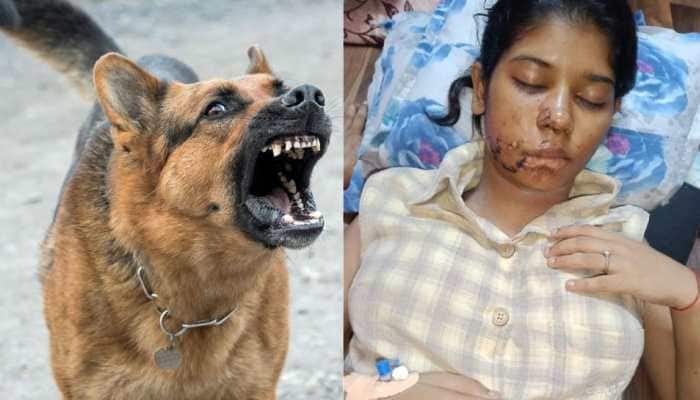 Kanpur Student Severely Injured In Stray Dog Attack, 17 Stitches On ...