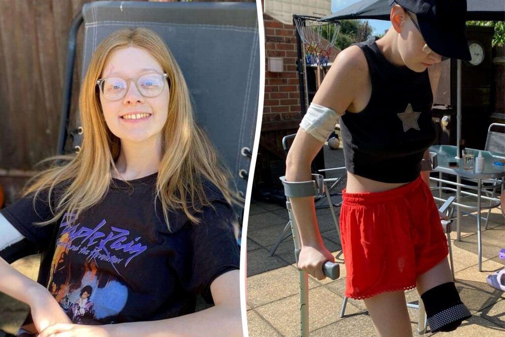 Woman, 20, has leg amputated after doctor says lump is ‘nothing to ...