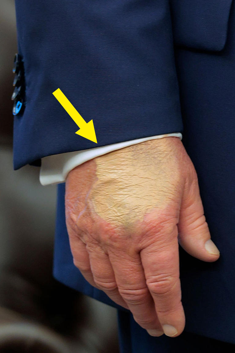 People Can't Stop Talking About Those New Viral Pictures Of Donald ...