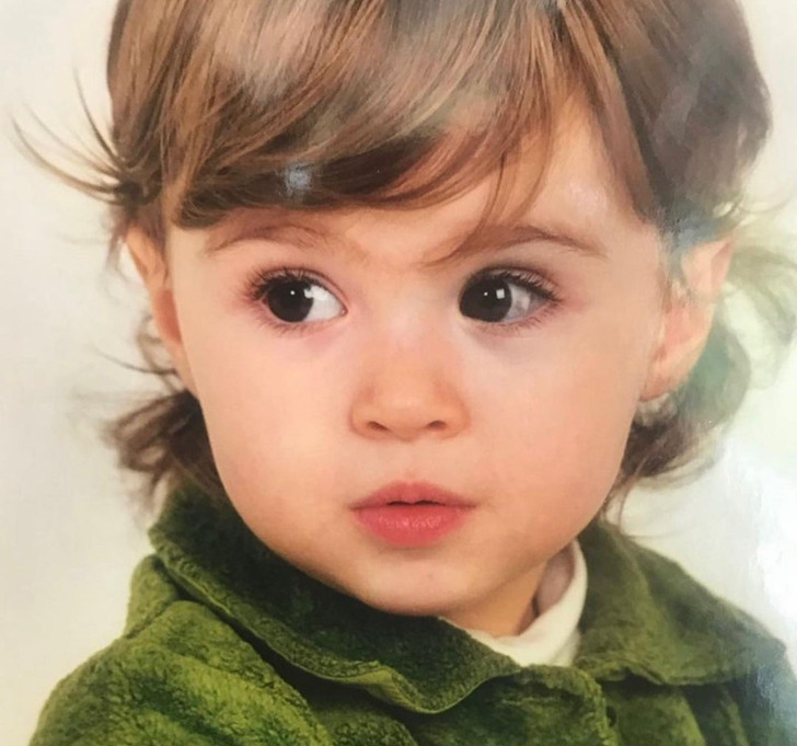 Model With Giant Birthmark Shares Her Journey to Self-Love