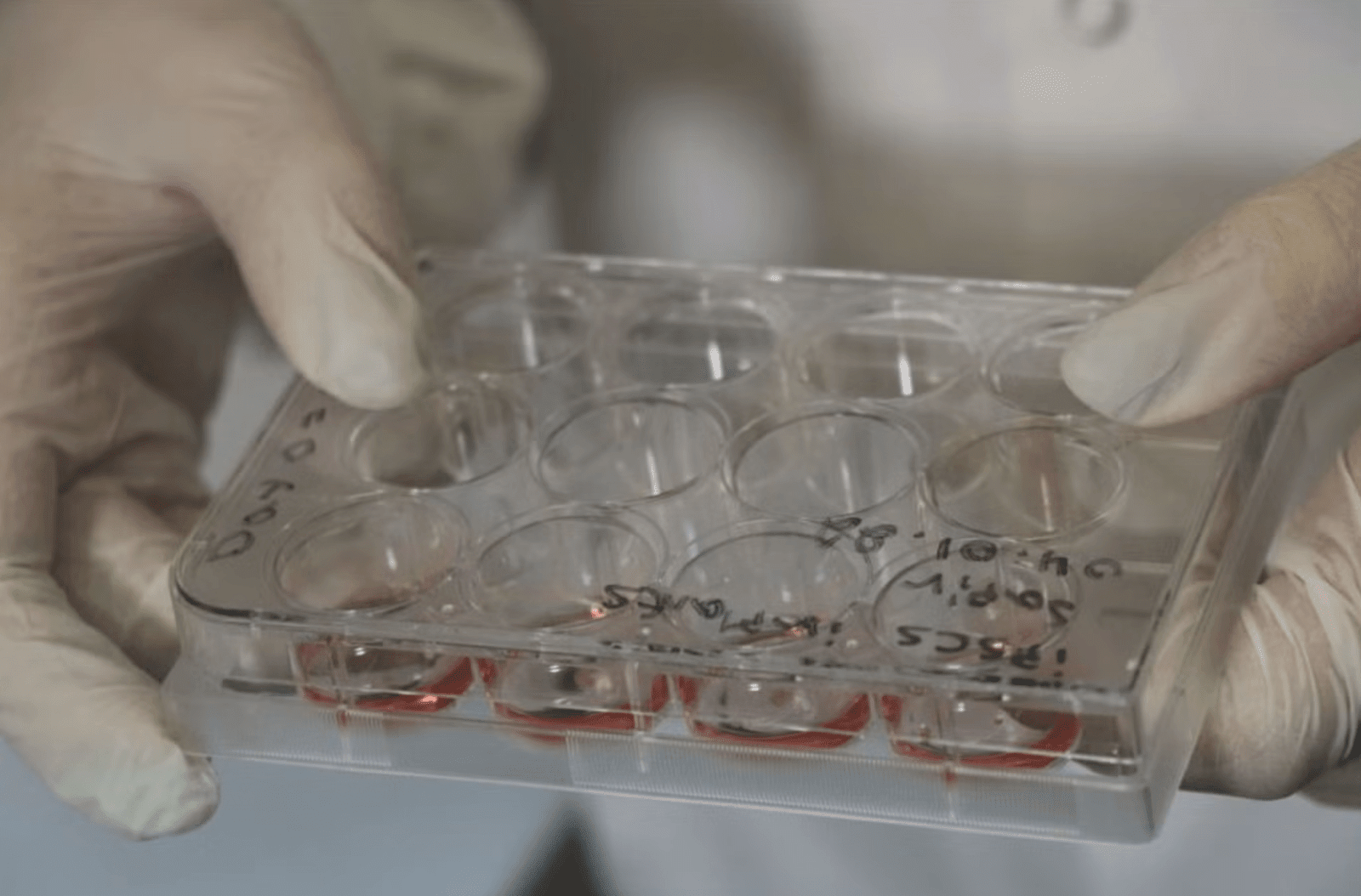 Israeli scientists to perform the world's first human spinal cord ...