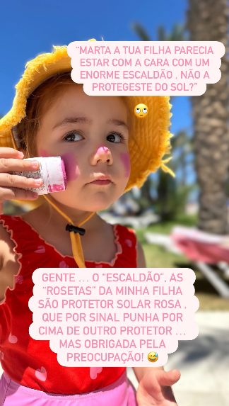 Filha de Marta Melro e Paulo Vintém "com a cara com um enorme escaldão"?