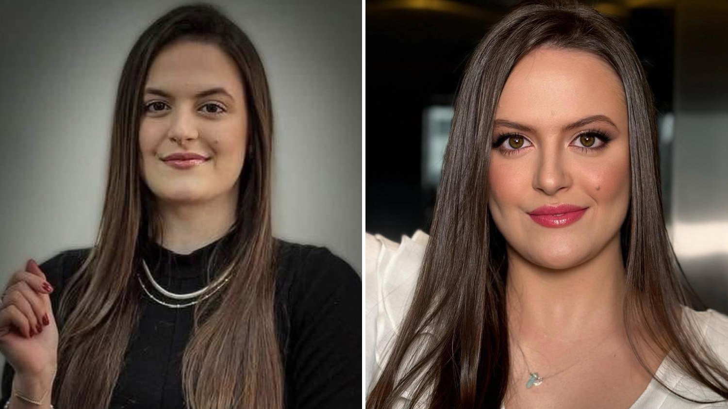 Woman, 22, dies after rare reaction to routine CT scan