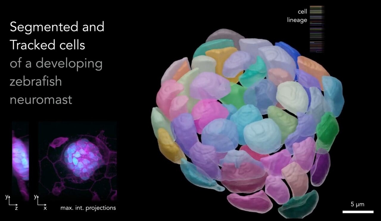 Ultrack and inTRACKtive: A powerful pair of tools to help track cells ...