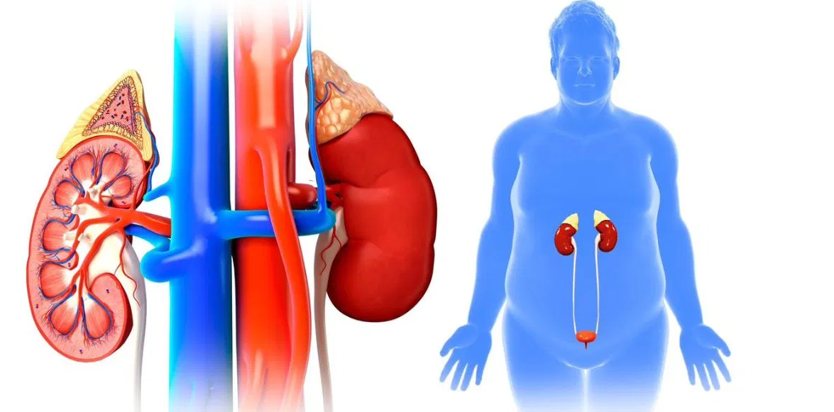 Fatty Kidney Disease: Not Just the Liver, Kidneys Too Can Become Fatty