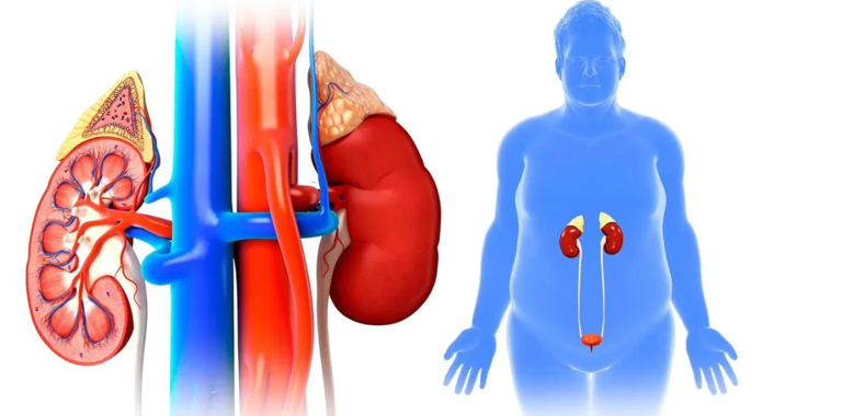 Fatty Kidney Disease: Not Just the Liver, Kidneys Too Can Become Fatty