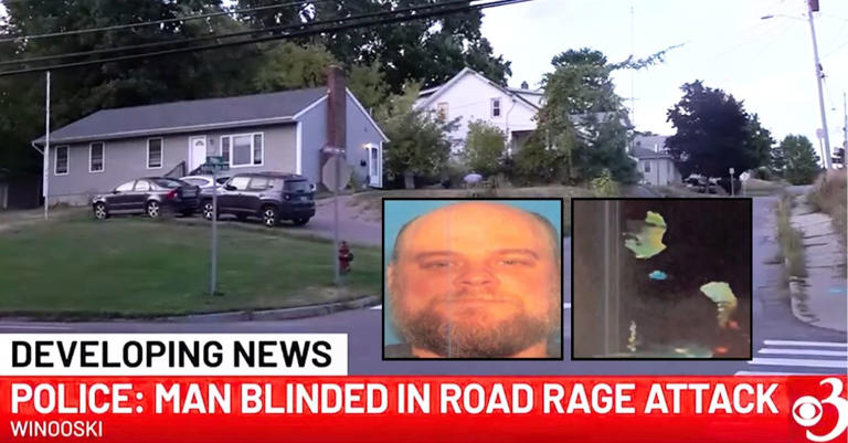 Driver uses thumbs to nearly gouge man's eyes out during 'road rage ...