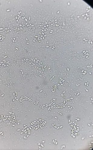 Exploring the World Through a Microscope - Fascinating Finds & Science ...