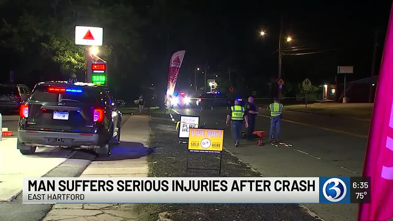 Man hospitalized after being struck by car in East Hartford