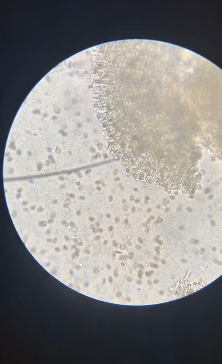 Do These Gills Freak Anyone Else Out?