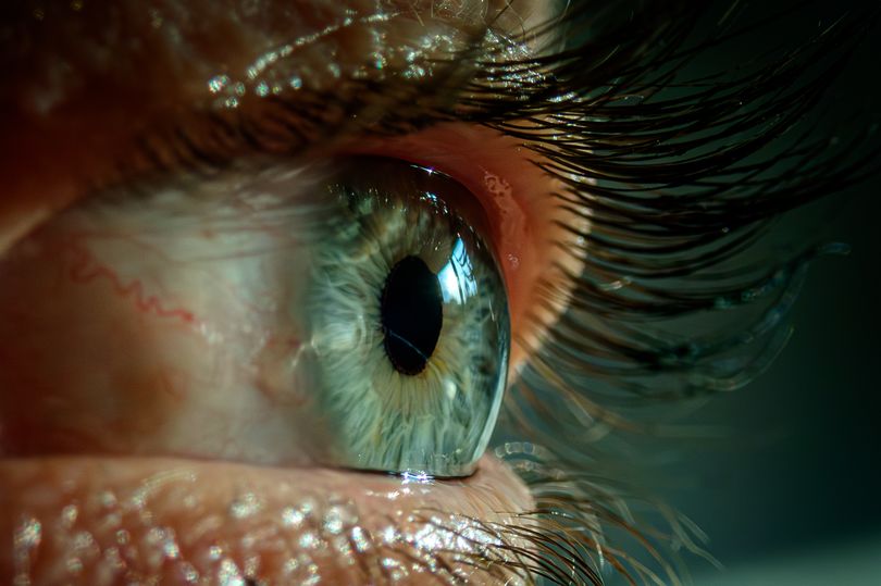 Dementia could be spotted 20 years early thanks to change in your eye