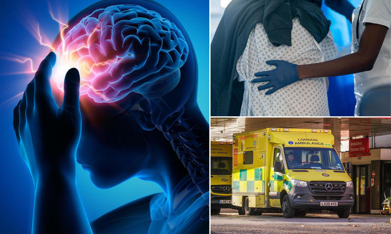NHS stroke centres given world-first AI tool that triples recovery ...