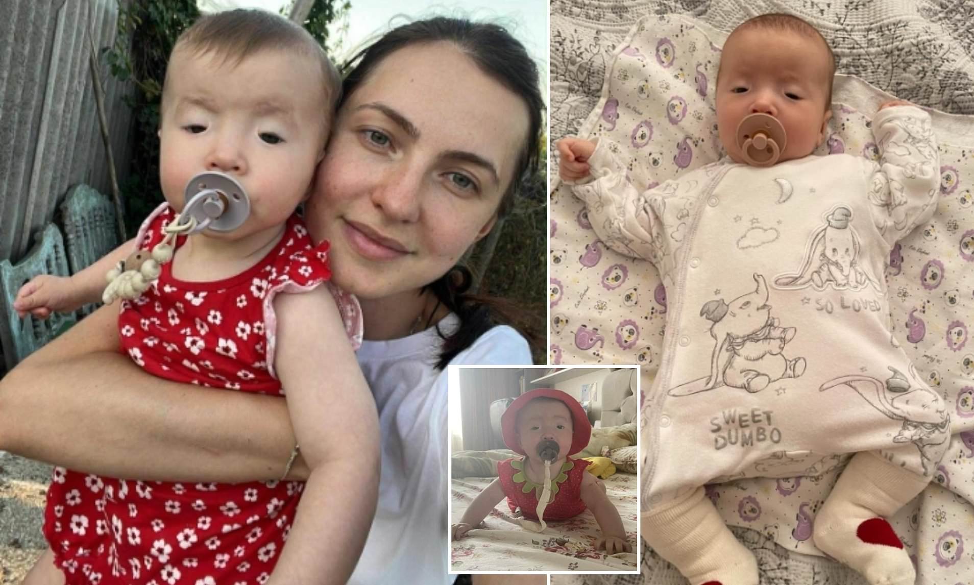 We thought our baby girl just hadn't opened her eyes yet... but the ...