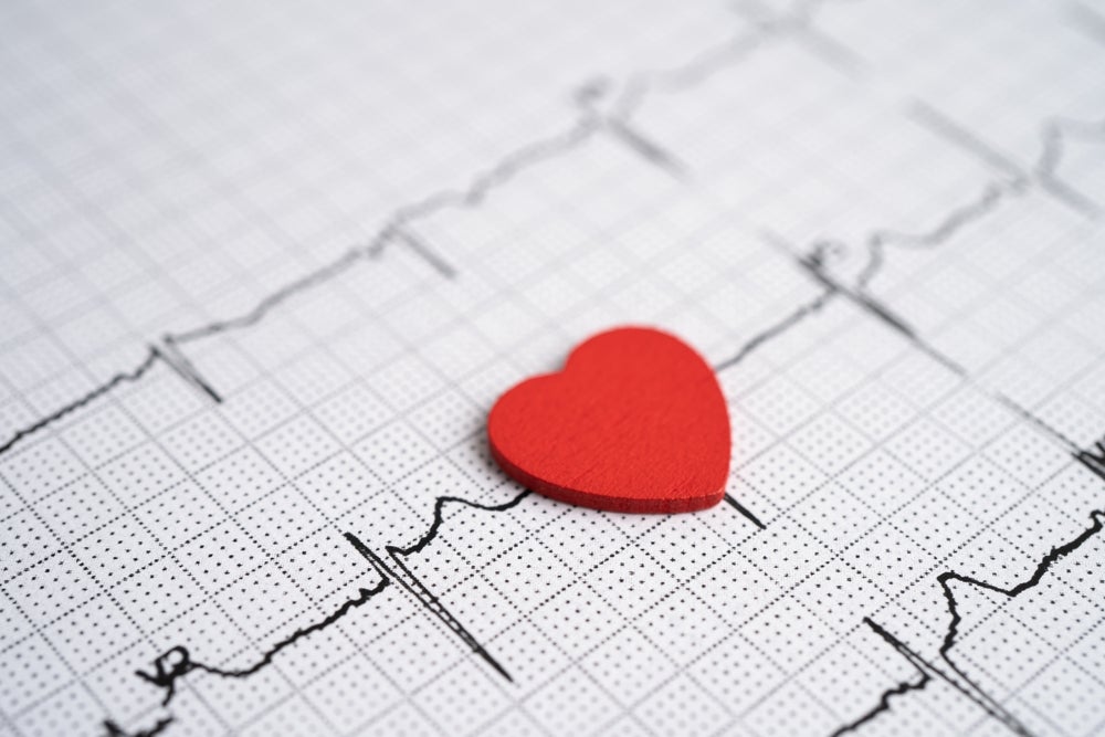 HeartBeam reports positive ECG data in heart attack detection