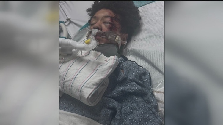 Family of metro Atlanta boy hurt in deadly Alabama ATV crash questions ...