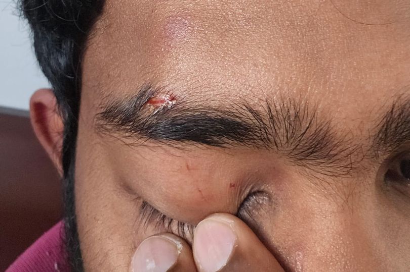 Indian Tesco worker hit with shopping trolley and attacked: 'Neighbours ...