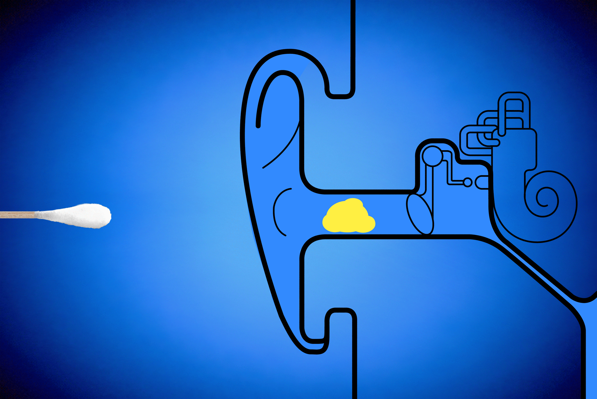 Here’s what can happen if you clean your ears with a cotton swab