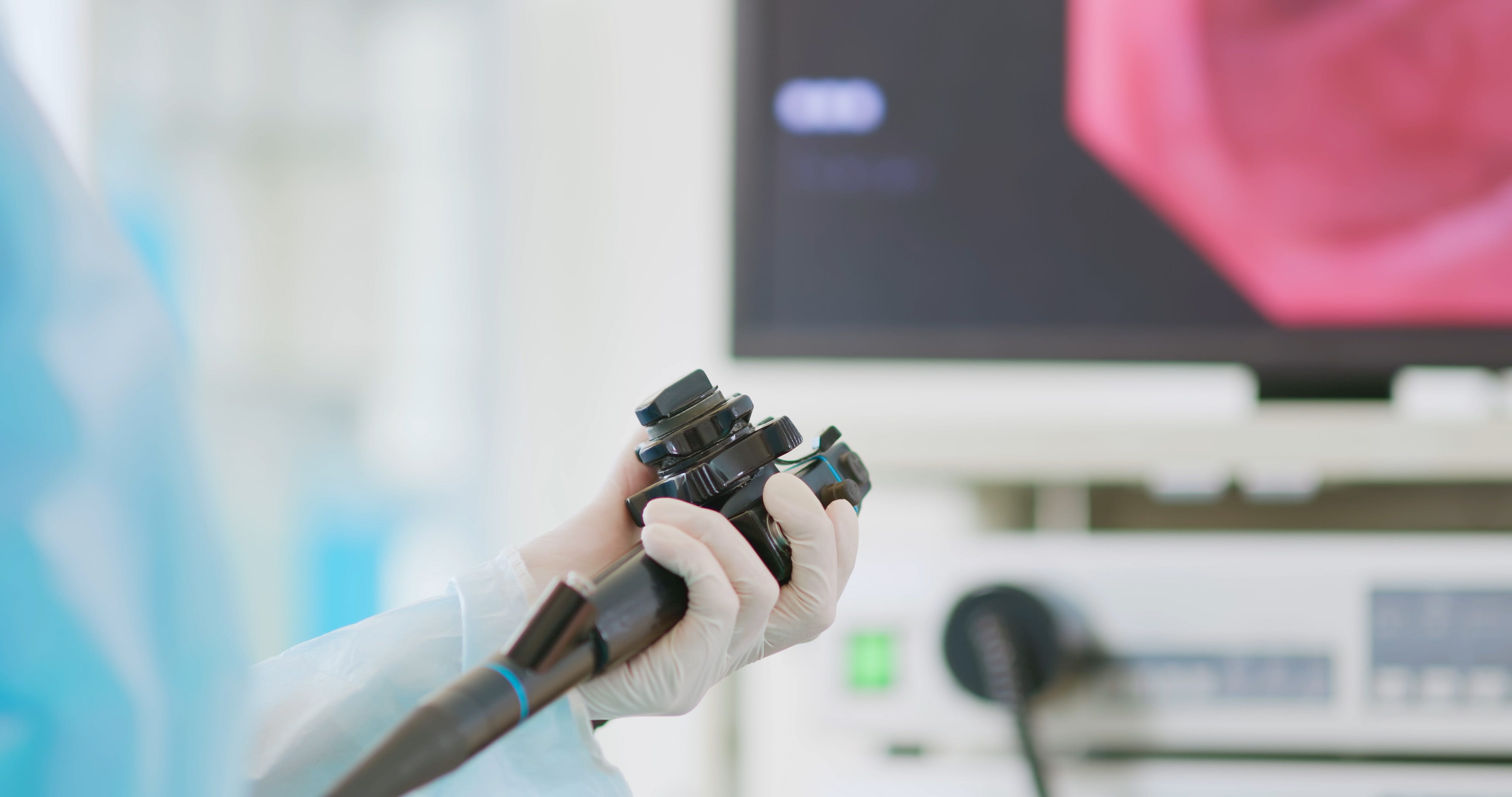 Colon cancer is rising in people under 50. Does lifestyle have anything ...