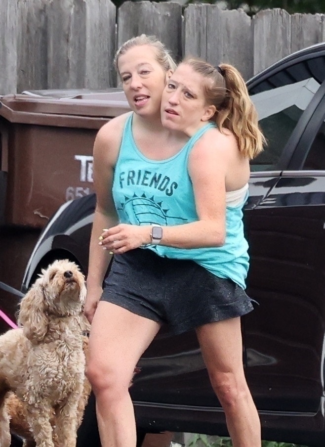 Conjoined twins Abby and Brittany Hensel address viral photos of them ...