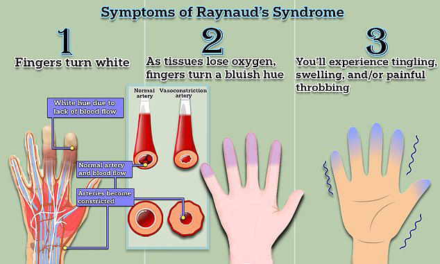 Doctors discover new potential treatment for condition that leaves ...