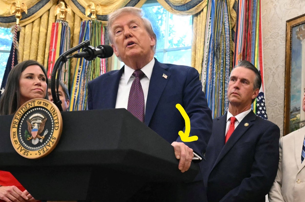 Here's How Bruised Donald Trump's Hand Was During The Press Conference ...