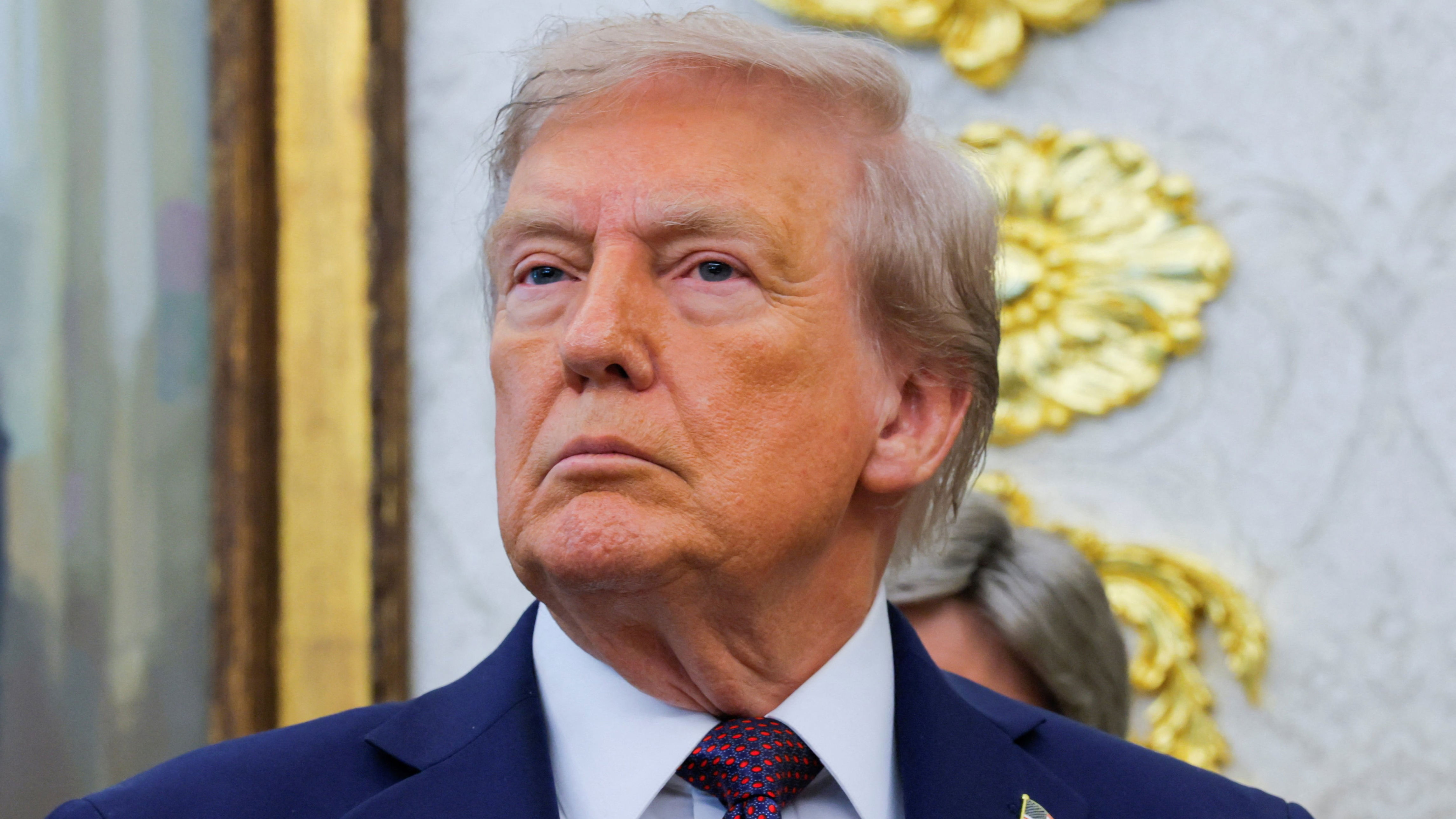 White House Finds New Way to Cover Up Trump Bruise