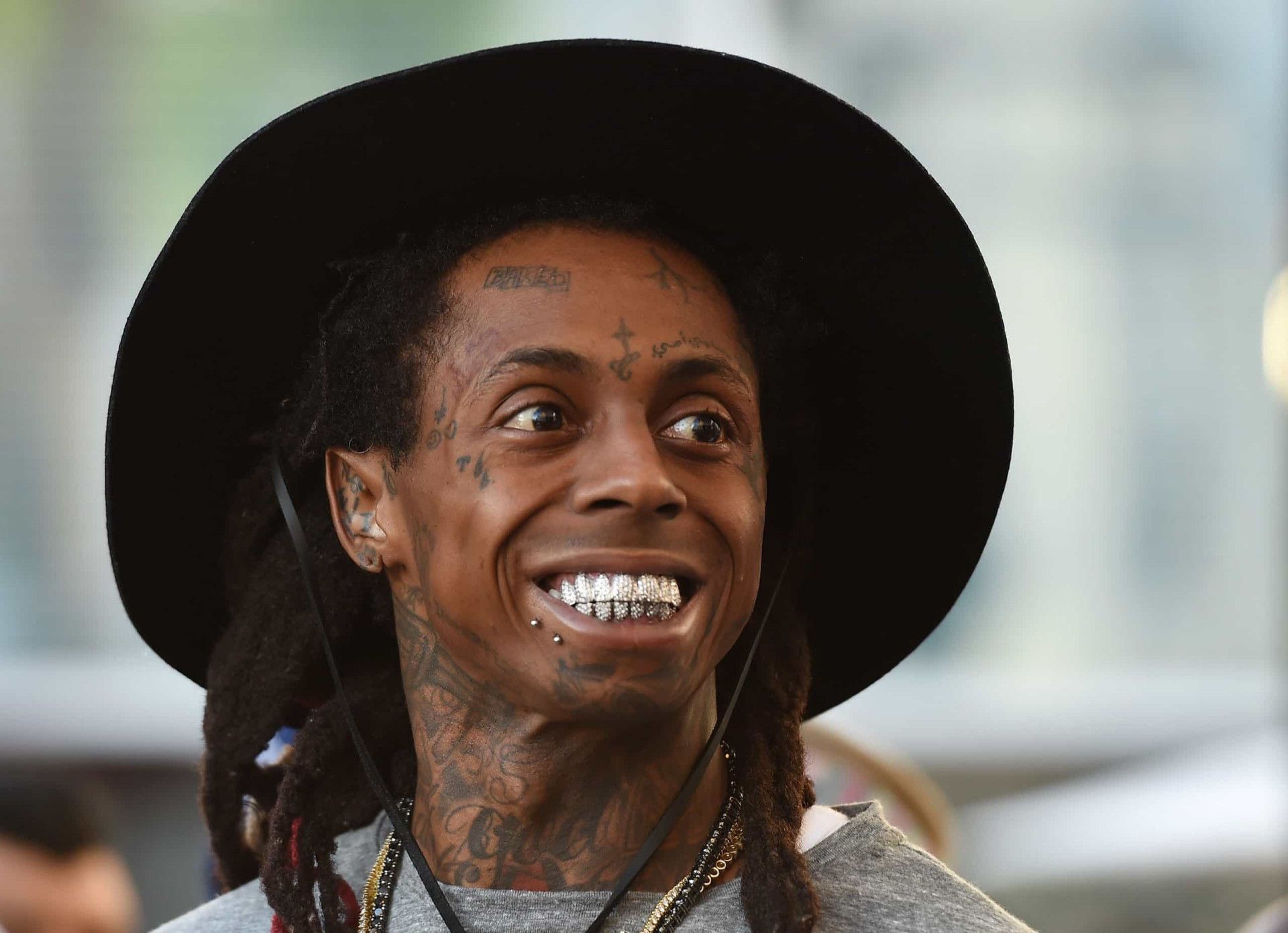 Celebrities living with epilepsy