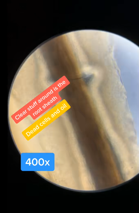 You Asked for Hair Under the Microscope – Here It Is!