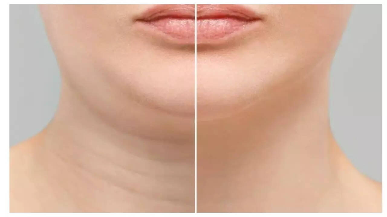 From heart health to diabetes risk: What neck size REVEALS about one's ...