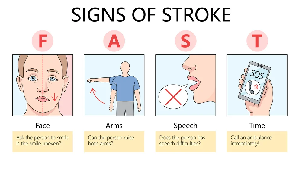 How to Spot a Stroke: Key Warning Signs and Fast Action Steps