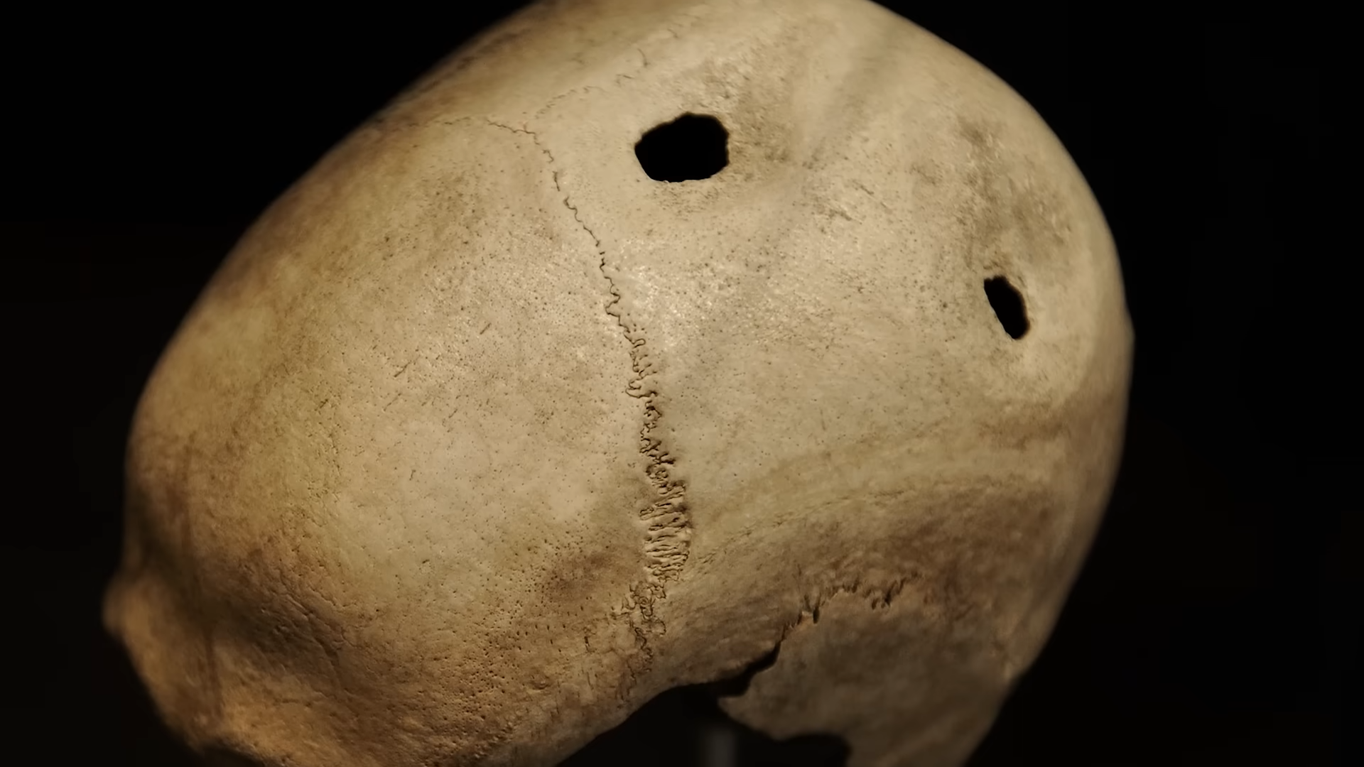 This is how the oldest brain surgery actually worked