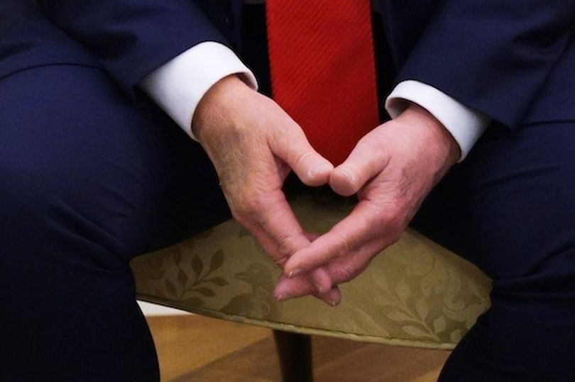 Donald Trump's bruised hand spotted again hours after he addresses ...