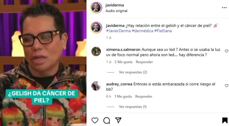 ¿El gelish da cáncer en la piel? Esto es lo que opina el Javi Derma, el ...